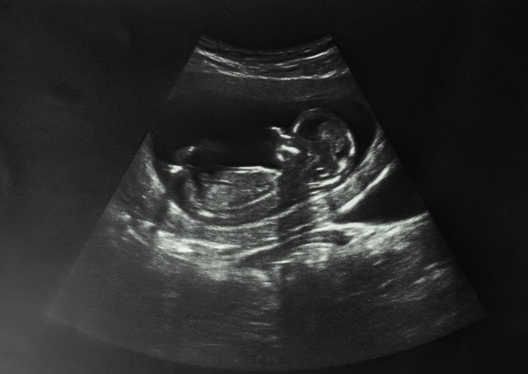 Court continues block of Ohio\'s 6-week abortion ban - Christian Today