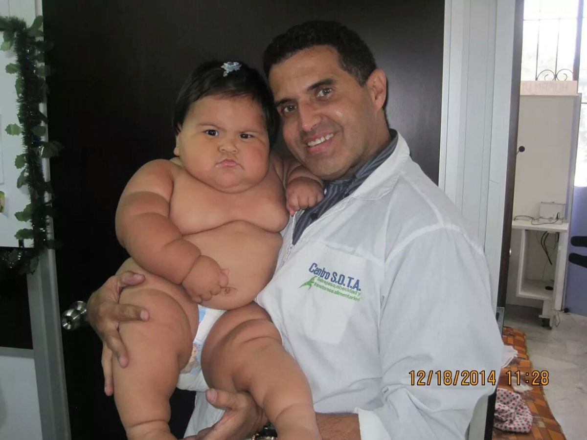 Doctors investigate baby\'s mysterious 38-lb. weight gain - Christian Today