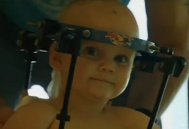\'Miracle\' as boy survives decapitation; Toddler alive and well ...